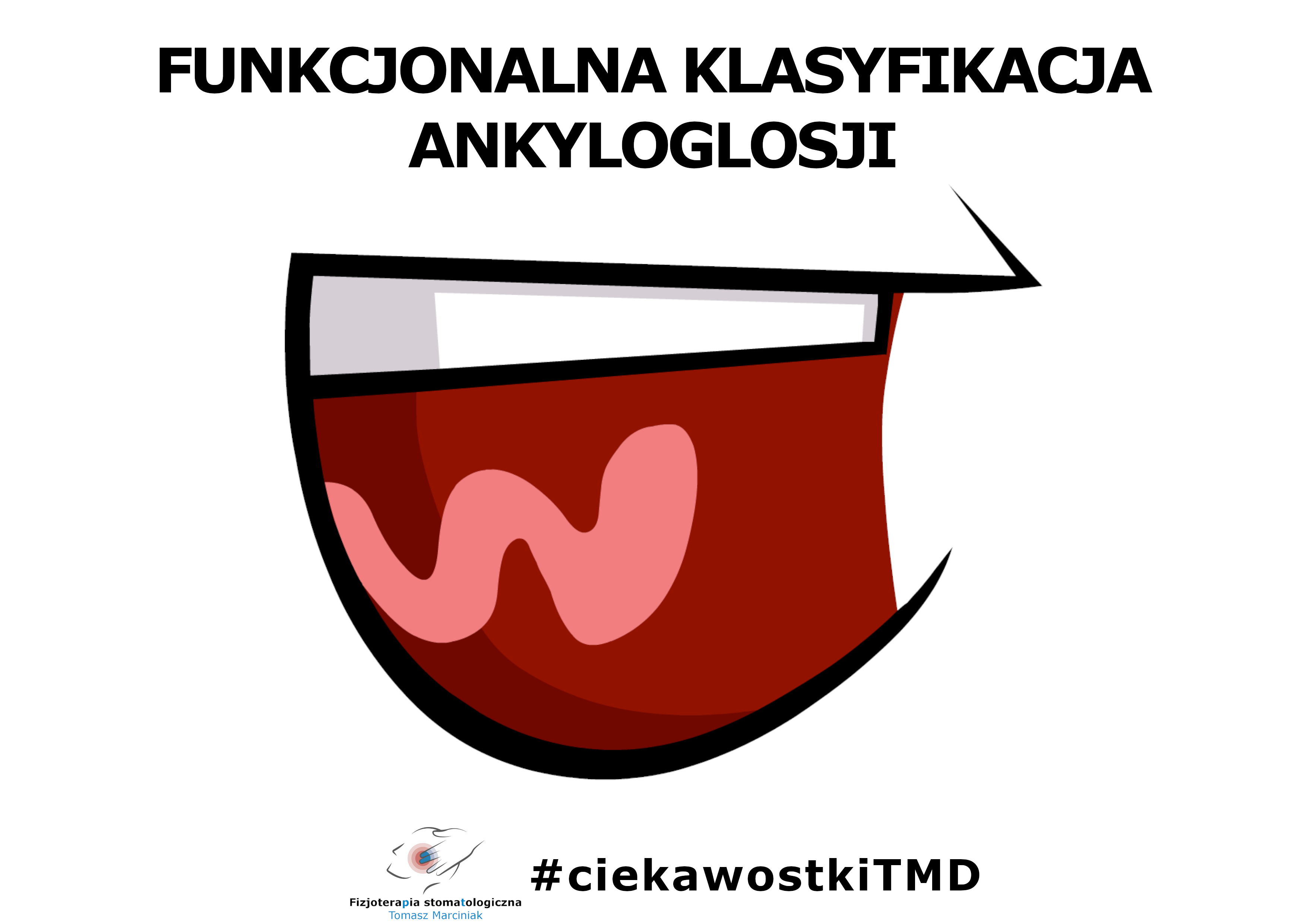 Fizjoterapia stomatologiczna » Funkcjonalna klasyfikacja ankyloglosji